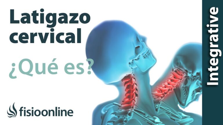 Descubre los Síntomas Más Comunes del Latigazo Cervical que Debes ...